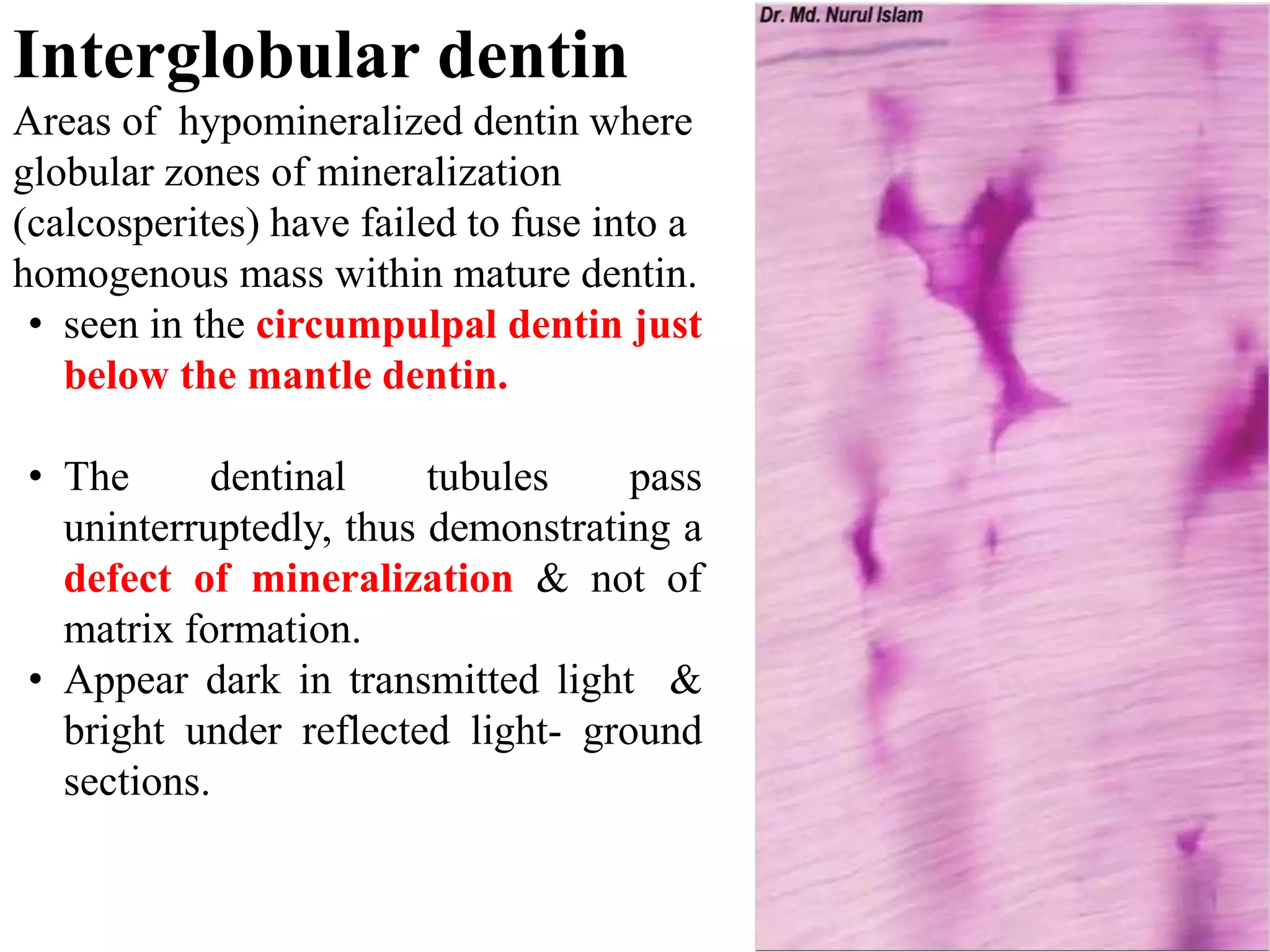 Pulp dentin complex | PPTX