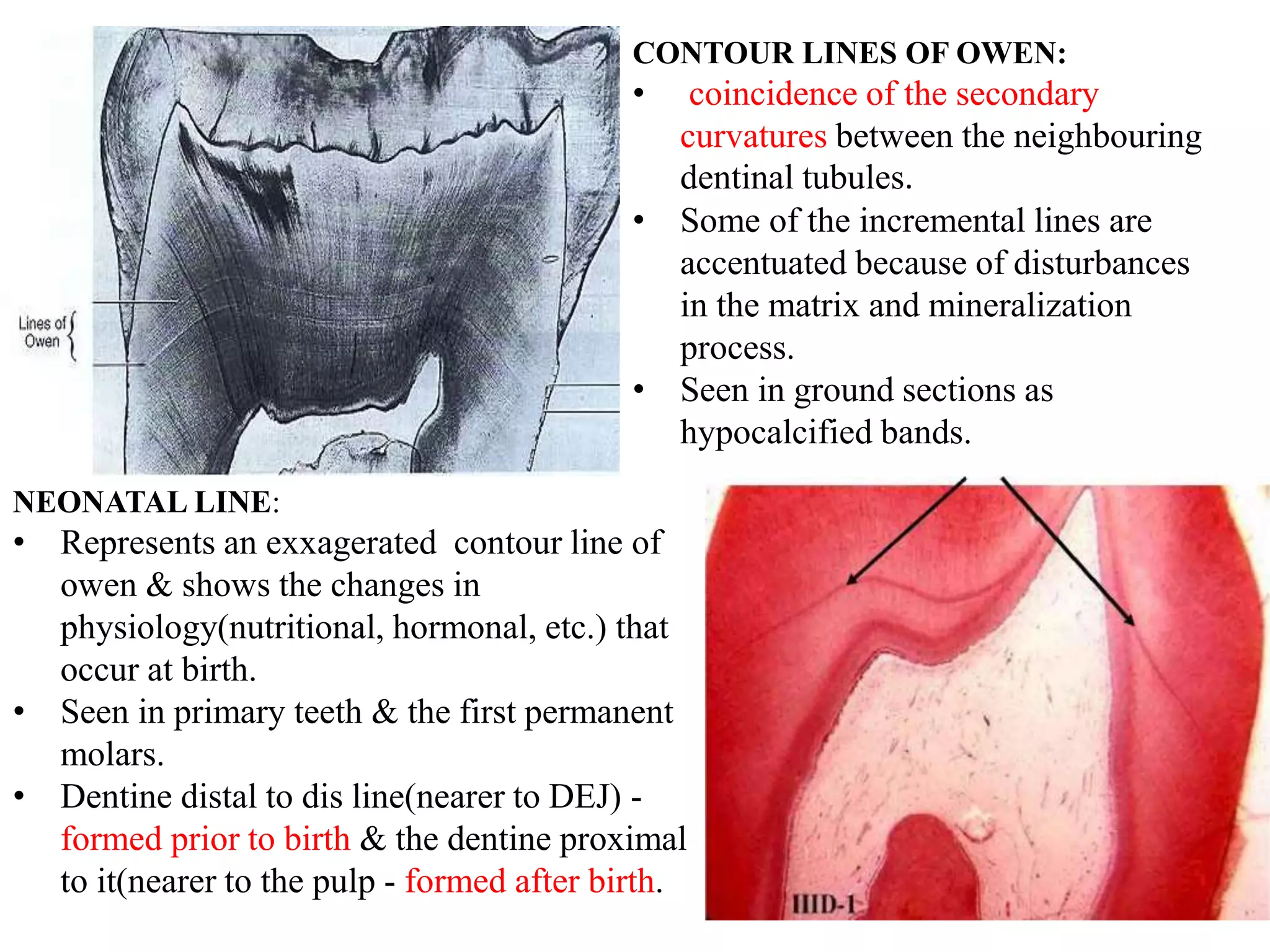 Pulp dentin complex | PPTX