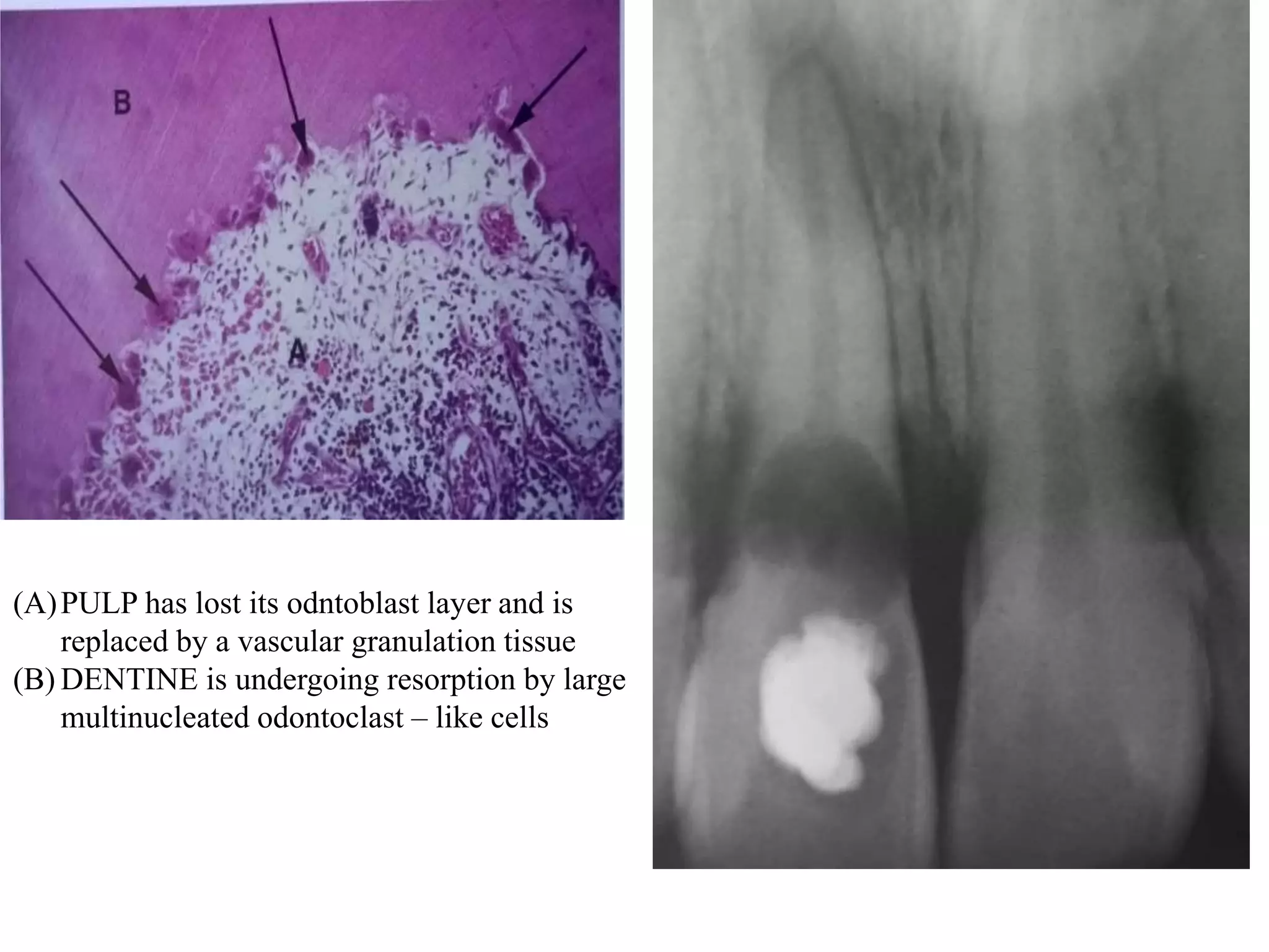 Pulp dentin complex | PPTX