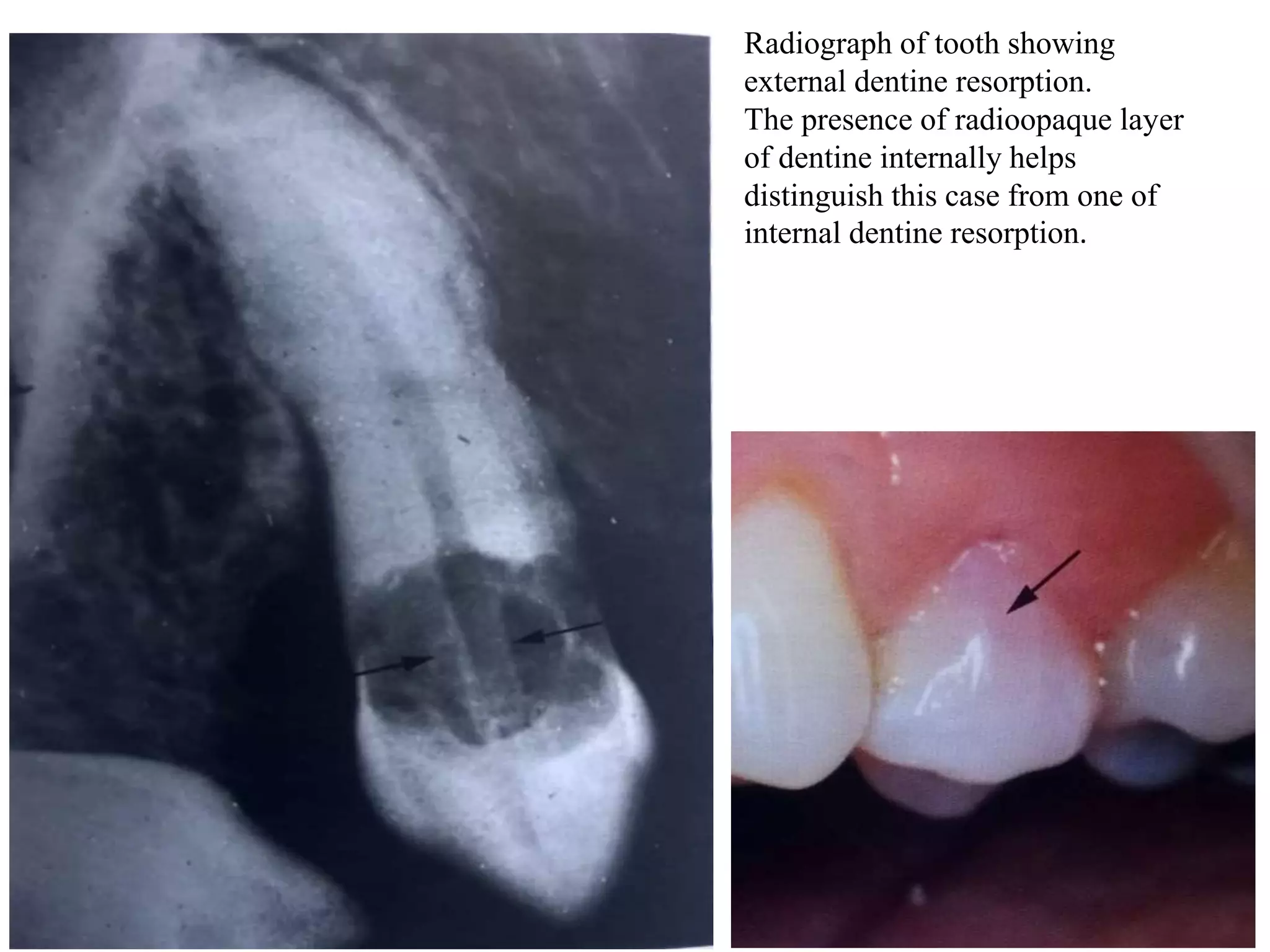Pulp dentin complex | PPTX