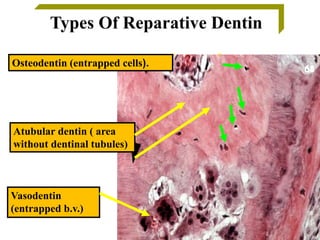 Pulp dentin complex | PPTX