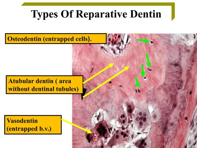 Pulp dentin complex | PPTX | Dental Health | Diseases and Conditions