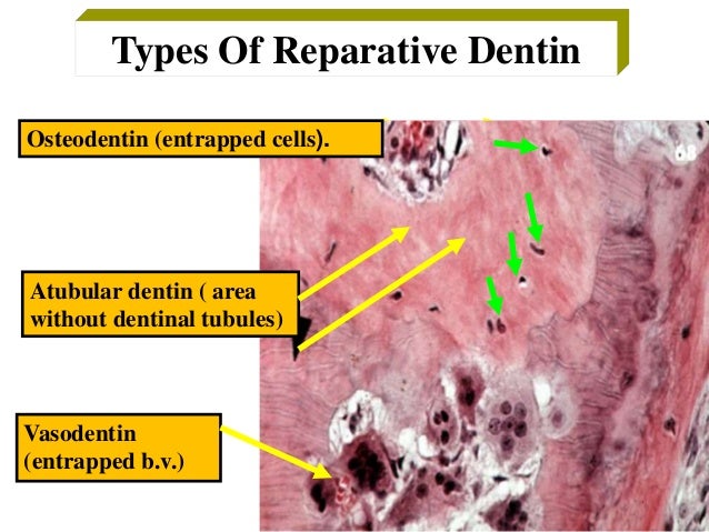 Pulp dentin complex