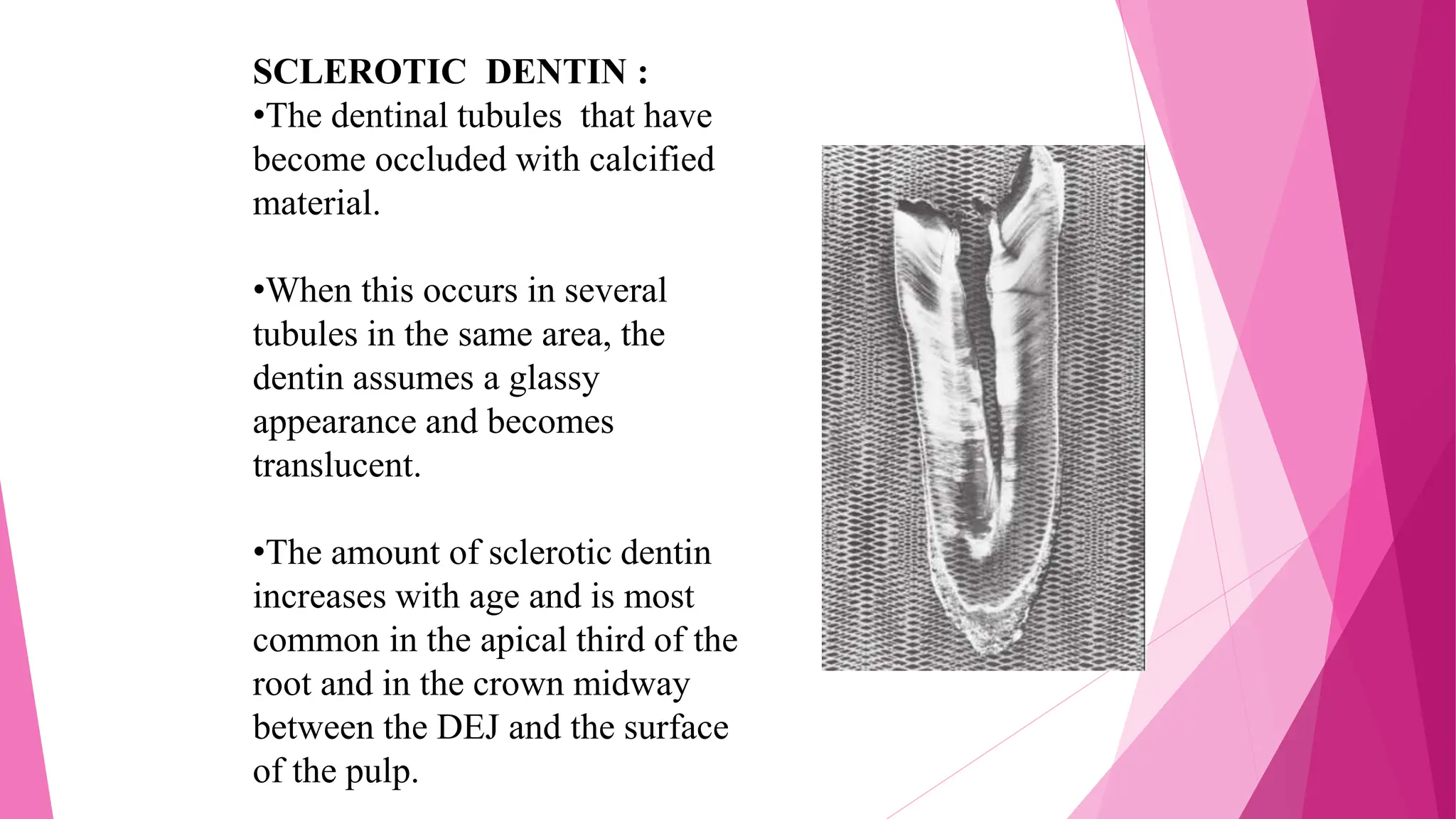 An overview on the Pulp Dentin Complex .pptx