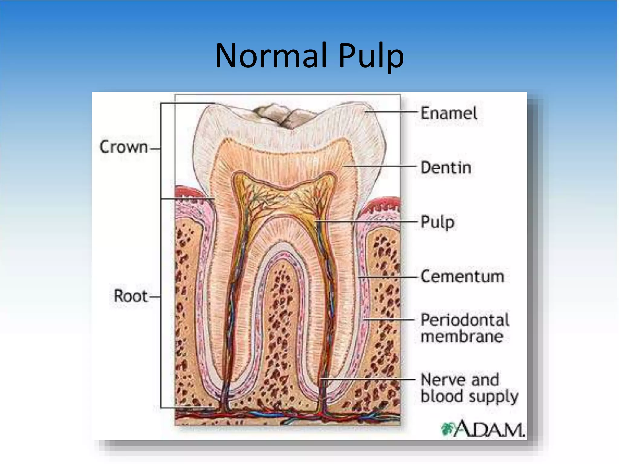 Pulp Diseases Pptx