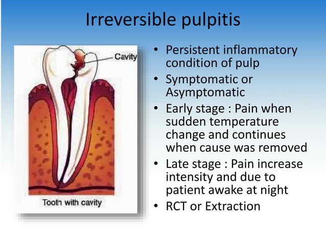 Pulp diseases | PPT