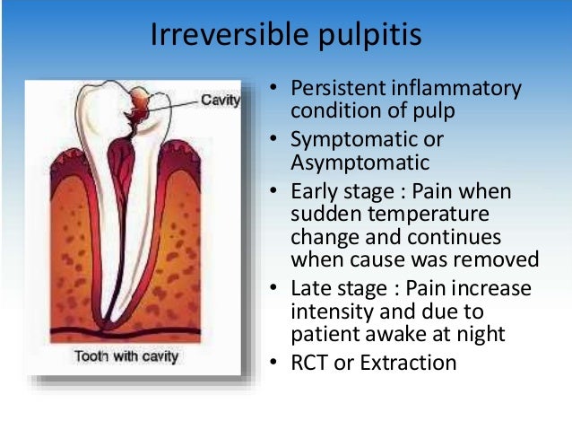 Pulp diseases