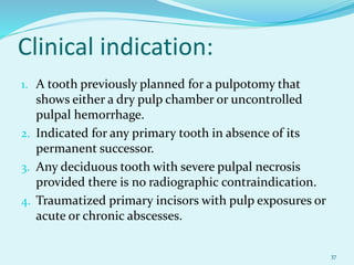 Pulpectomy | PPTX