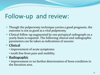 Pulpectomy | PPTX