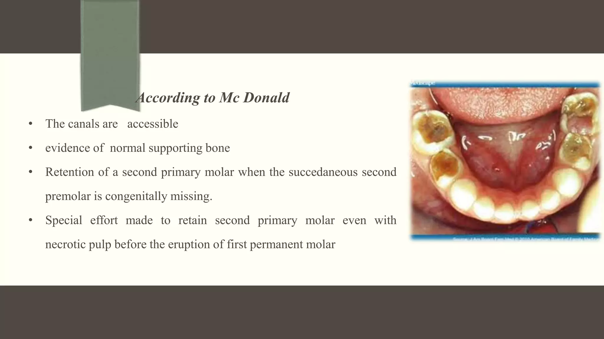 Pulpectomy | PPTX