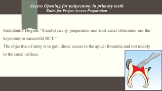 Pulpectomy | PPTX