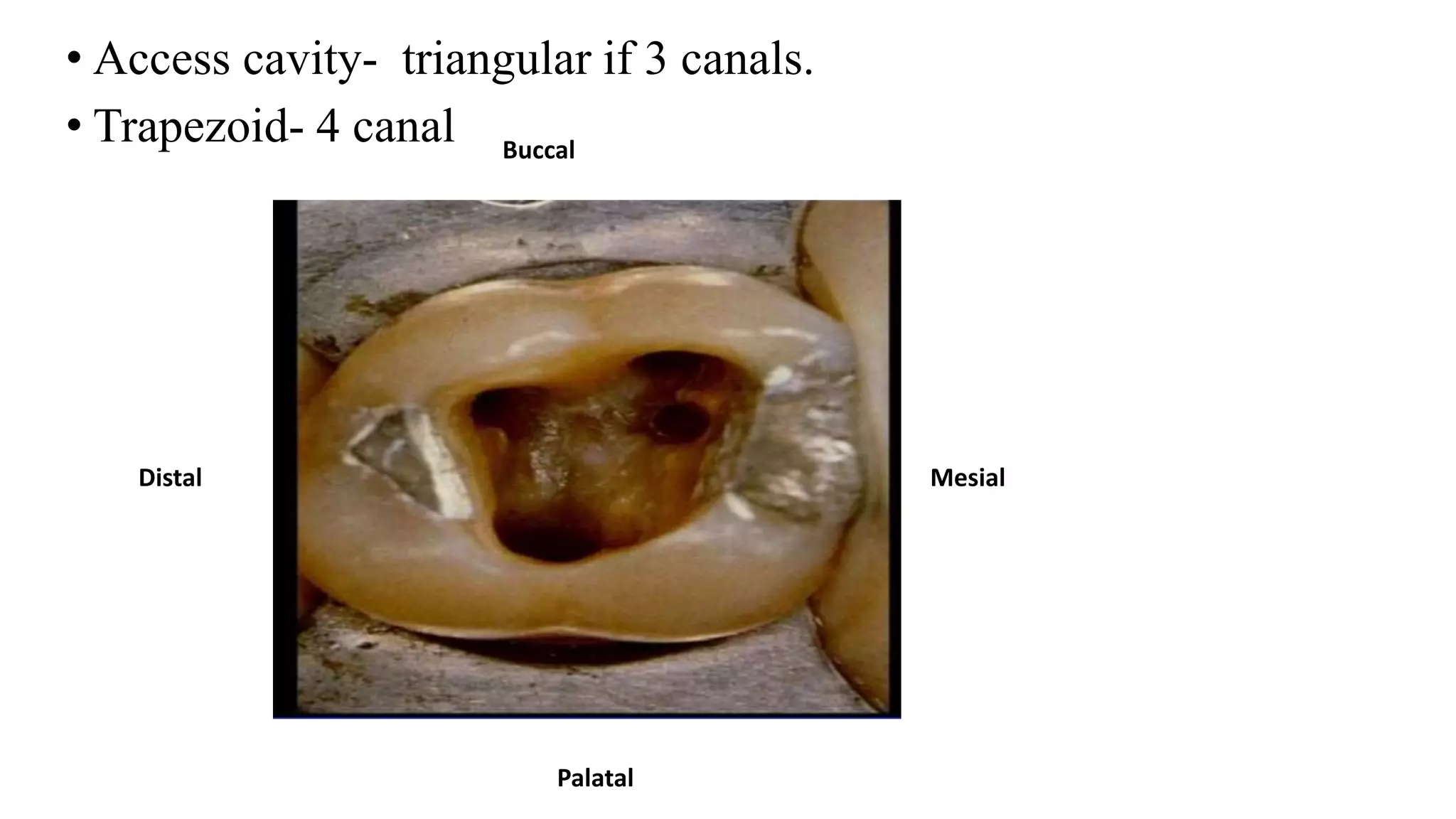 Pulpectomy copy | PPTX