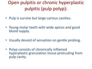 Pulpitis OD | PPT