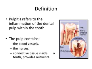 Pulpitis OD | PPT