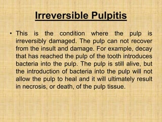 Pulpitis | PPTX