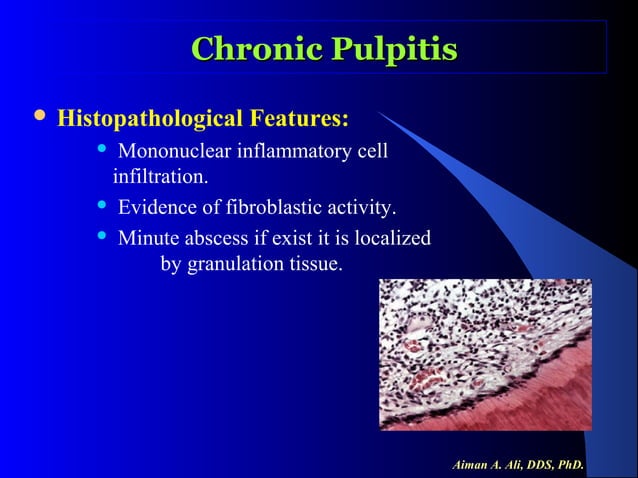 Pulpitis | PPT