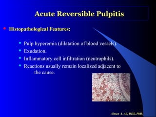 Pulpitis | PPT