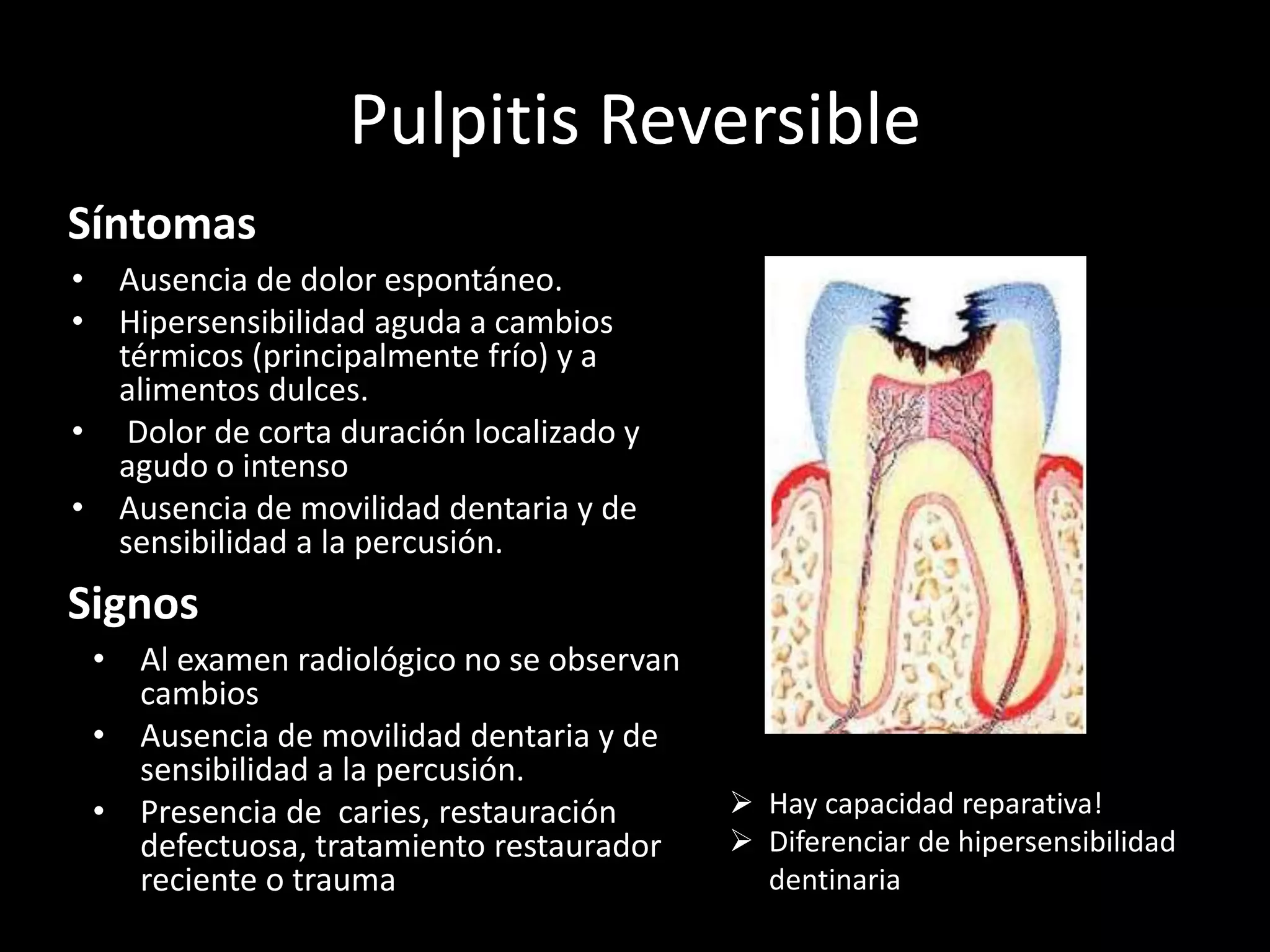 Pulpitis Aguda. Diagnostico | PPT