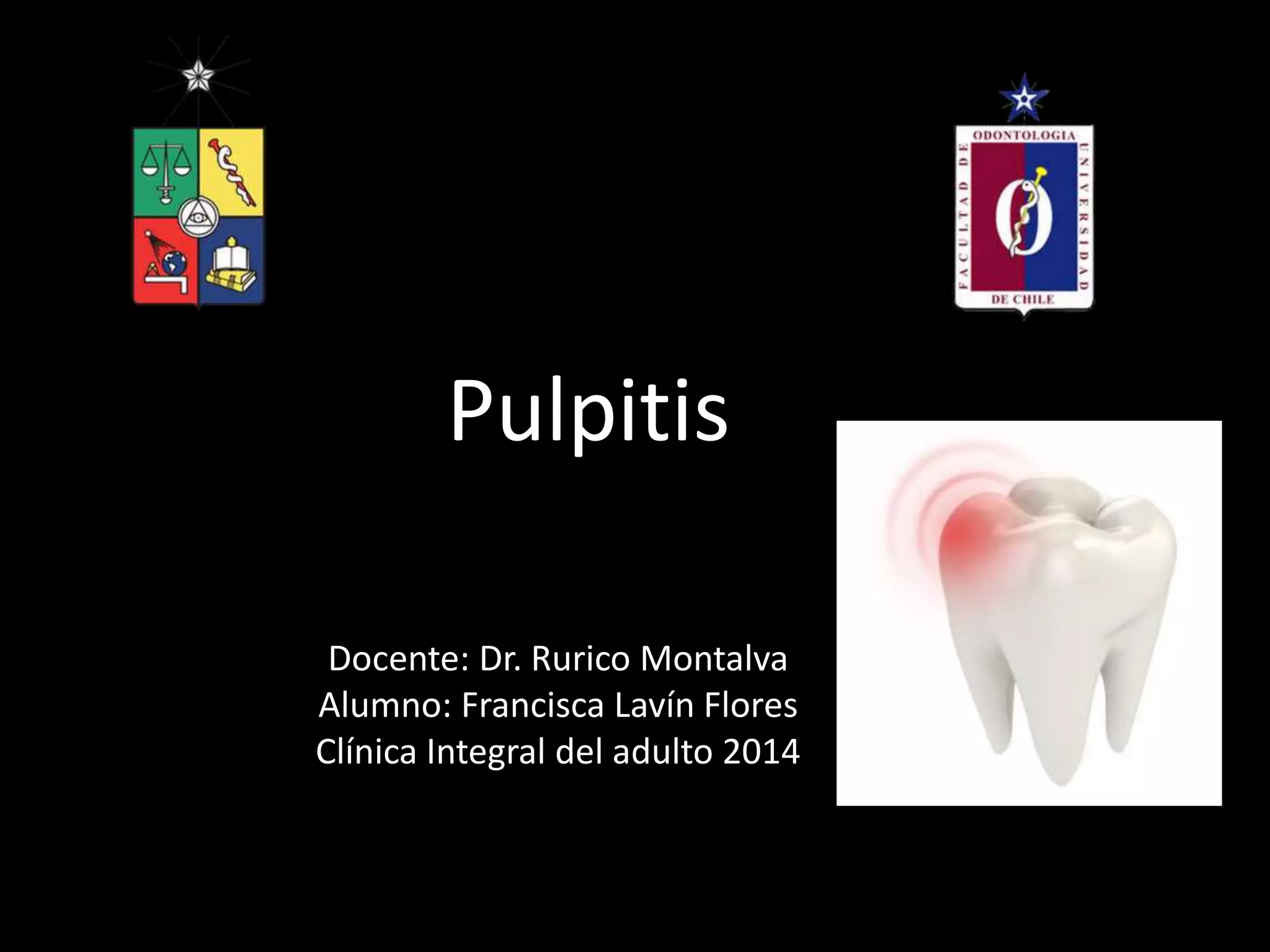Pulpitis Aguda. Diagnostico | PPT