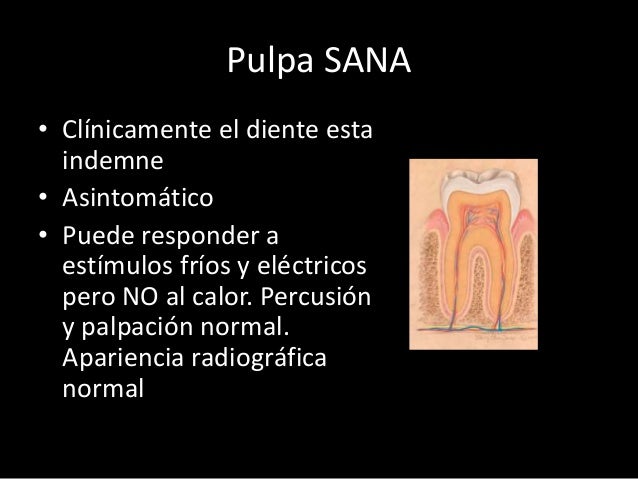 Histologia De La Pulpitis