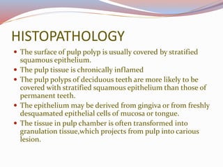 Pulpitis | PPTX