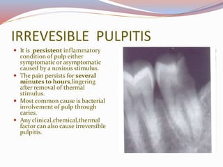 Pulpitis | PPTX