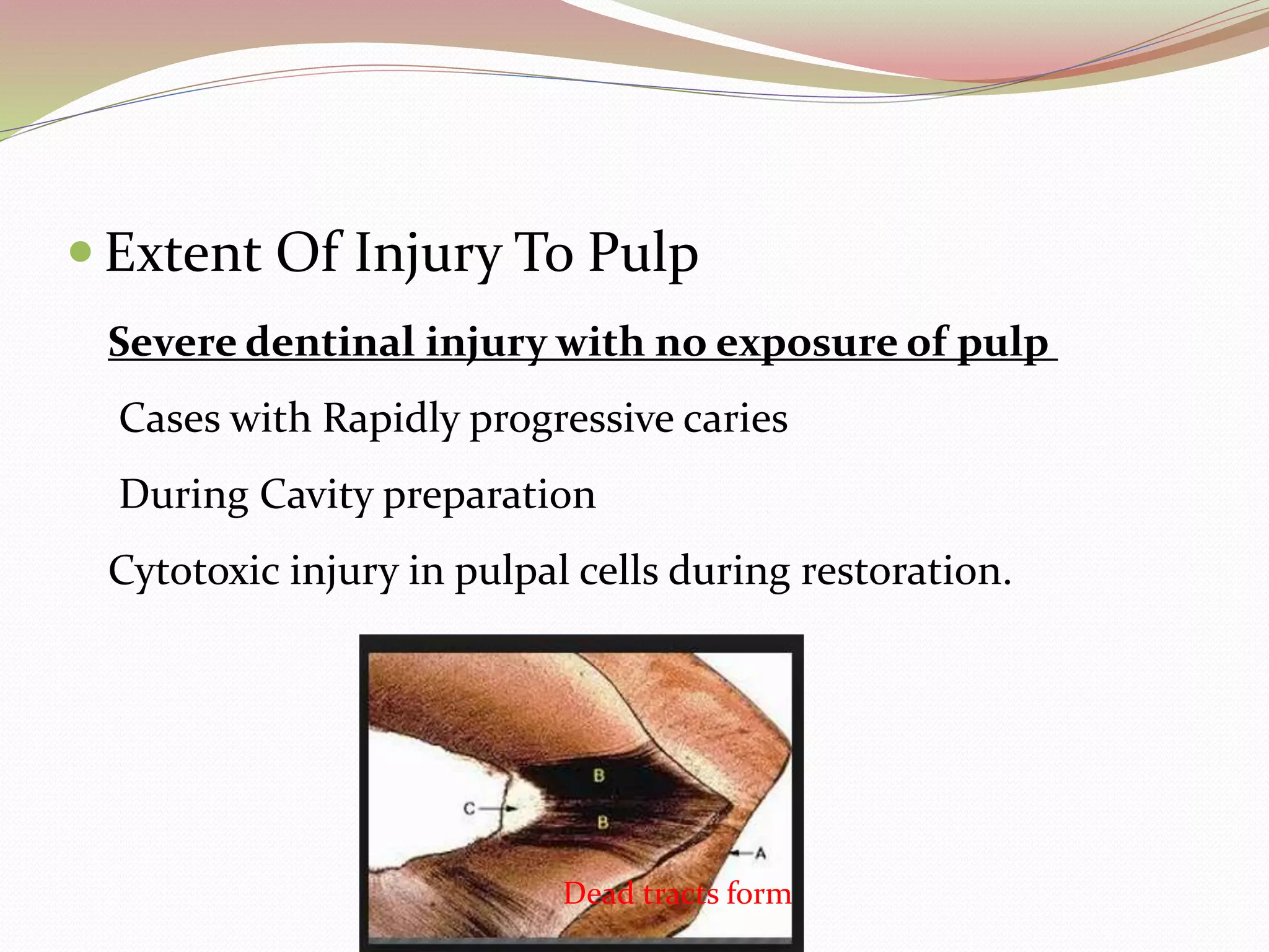 Pulpitis | PPTX