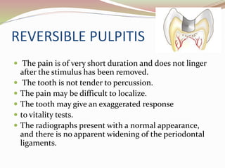 Pulpitis | PPTX