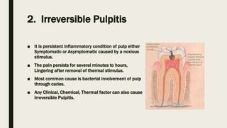 Pulpitis | PPTX