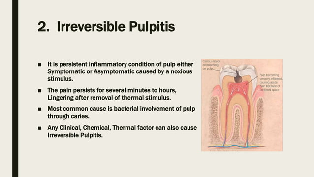 Pulpitis | PPTX