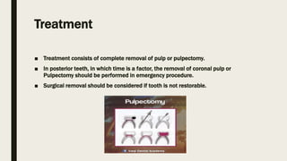 Pulpitis | PPTX