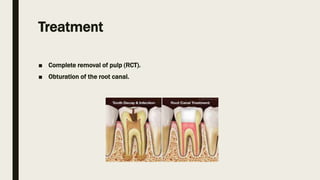 Pulpitis | PPTX