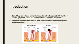 Pulpitis | PPTX