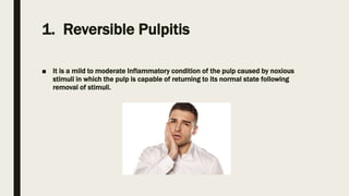 Pulpitis | PPTX