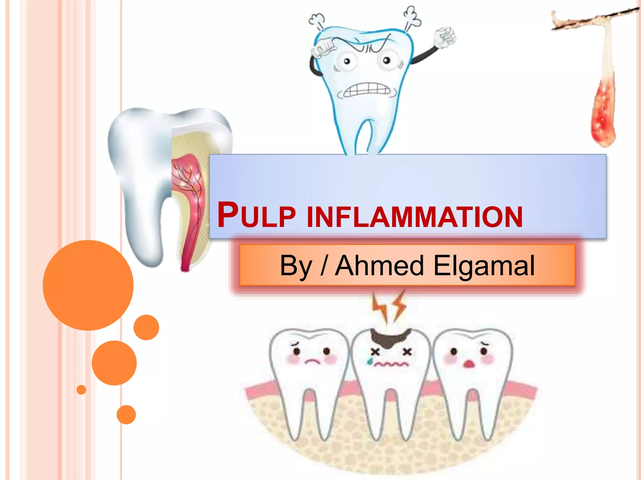 Dental Pulp Inflammation Causes and Types | PPT
