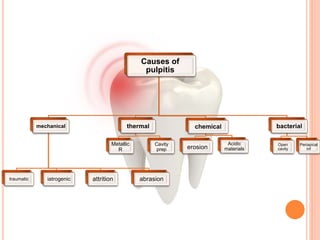Pulpitis | PPTX