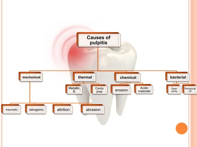 Pulpitis | PPTX | Dental Health | Diseases and Conditions