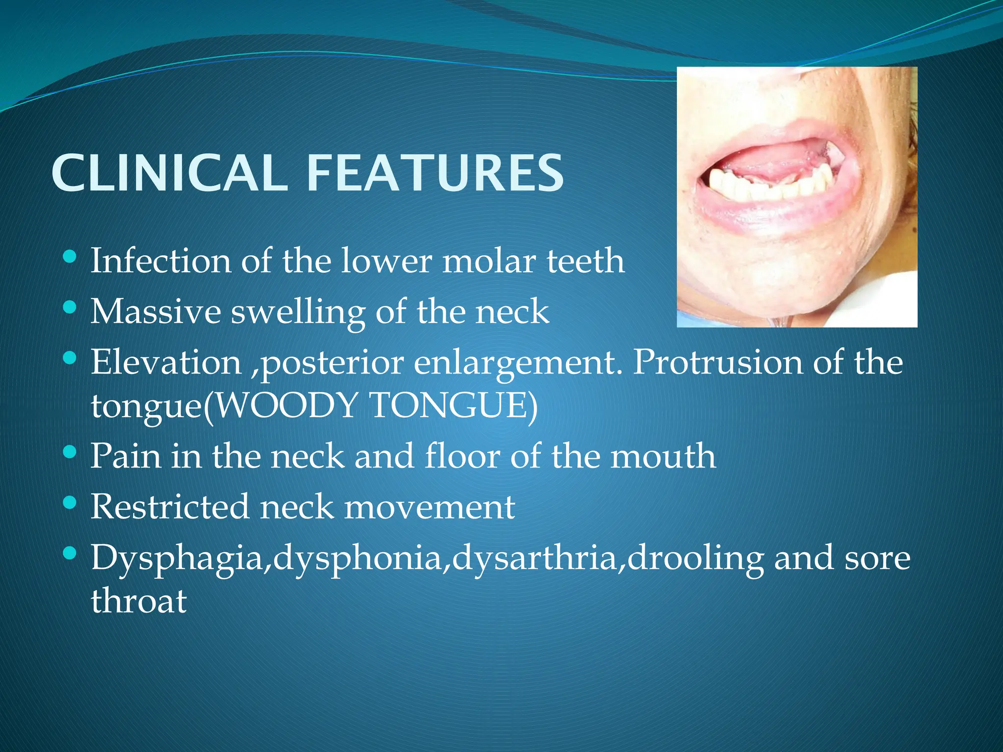 pulpitis and osteomyelitis types and classification.pptx