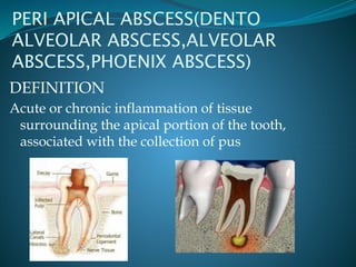 pulpitis and osteomyelitis types and classification.pptx