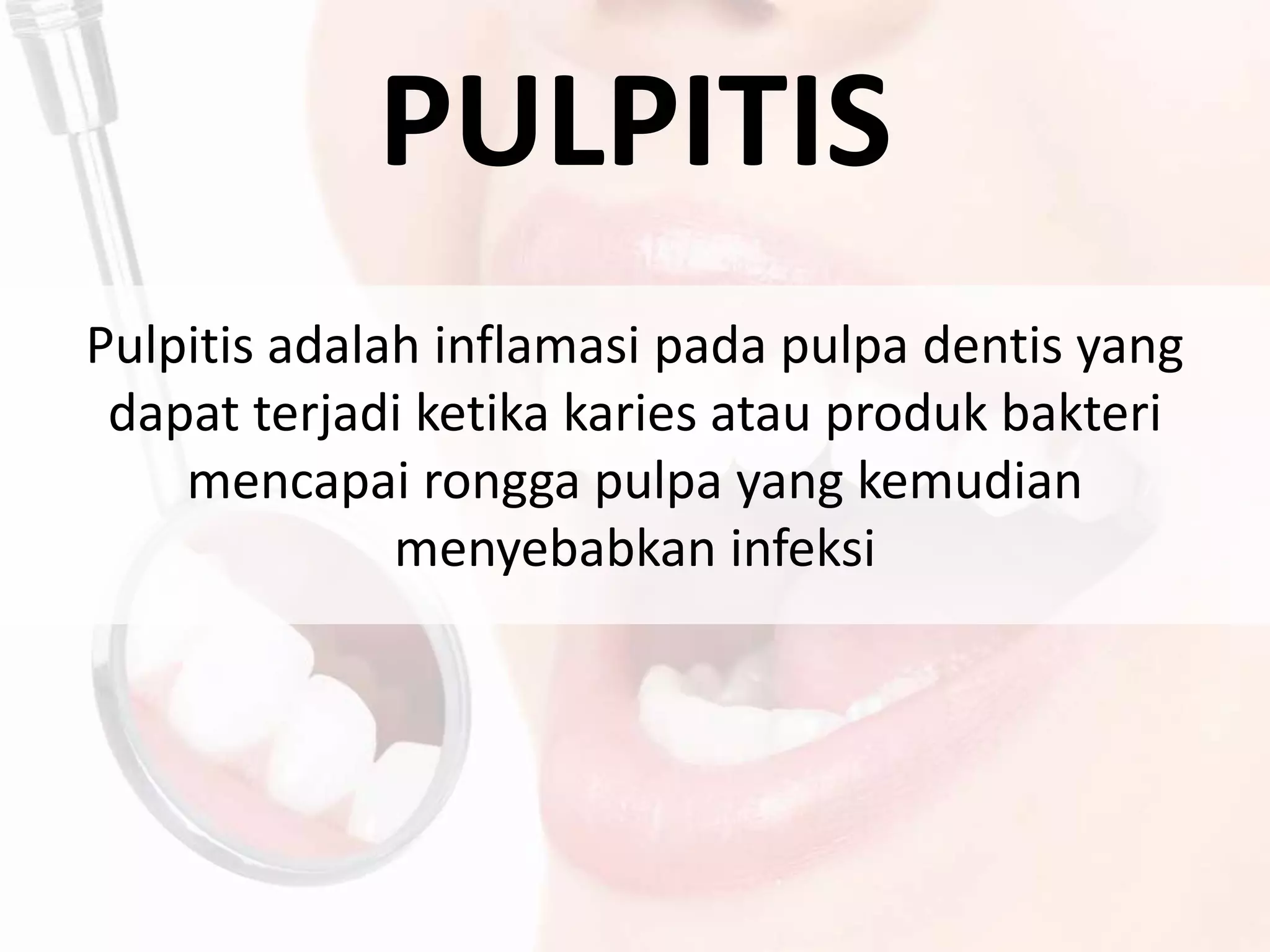 Pulpitis irreversibel | PPSX