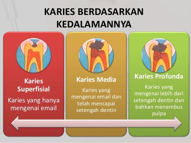 Pulpitis irreversibel