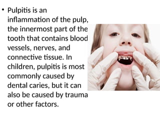 Pulpits in children and it’s symptoms and treatment | PPTX