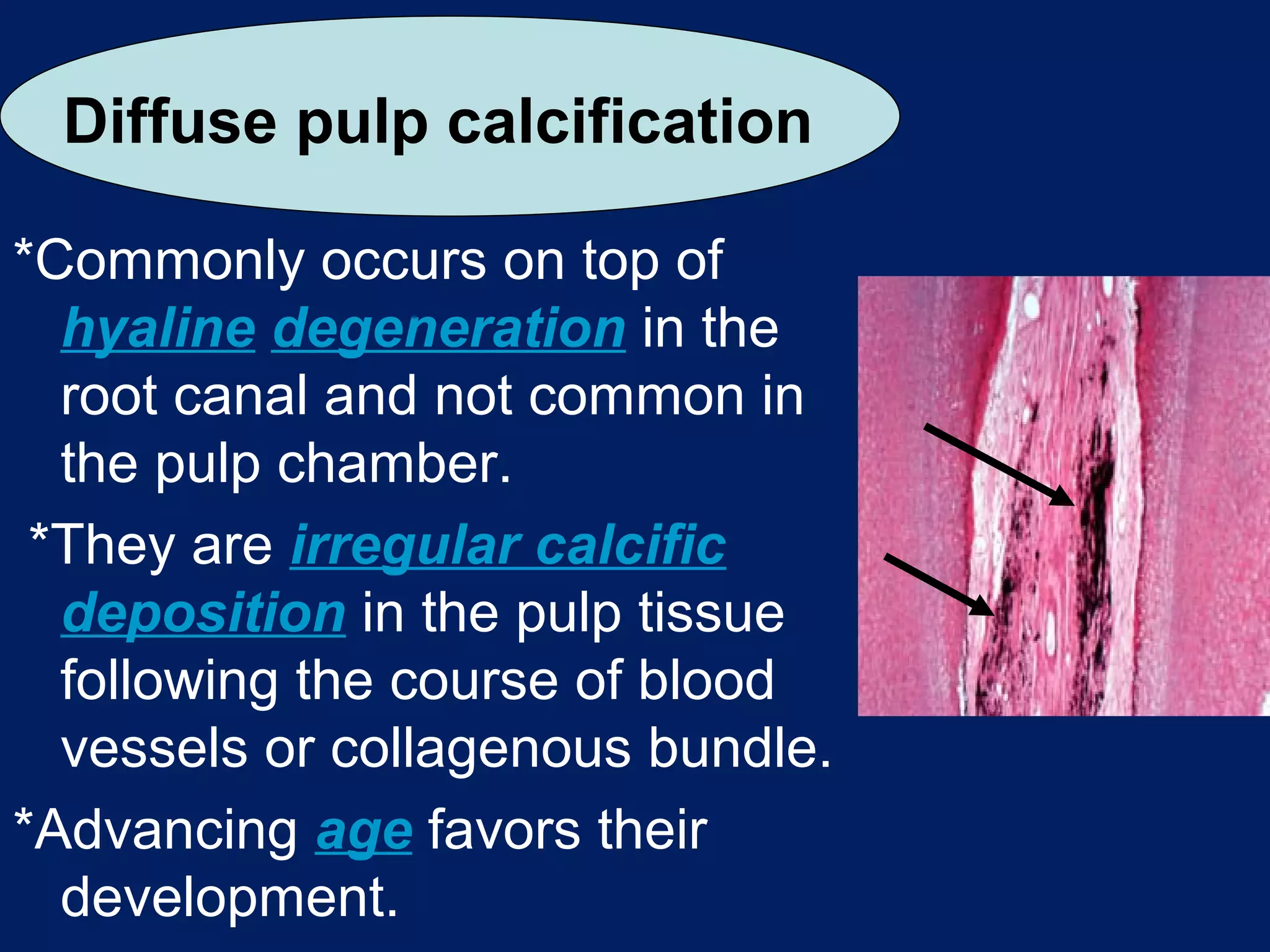 Dental Pulp | PPT
