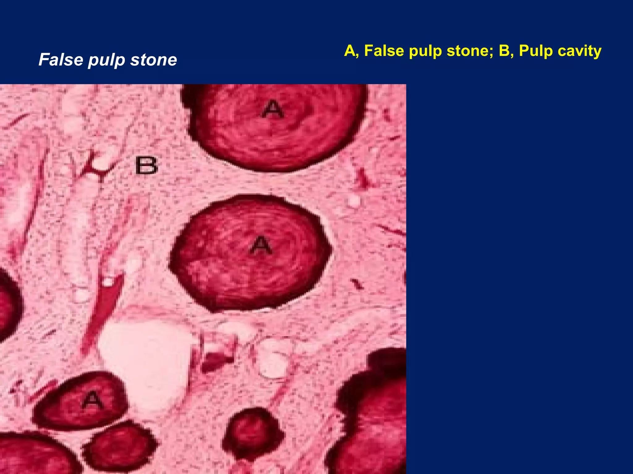 Dental Pulp | PPT