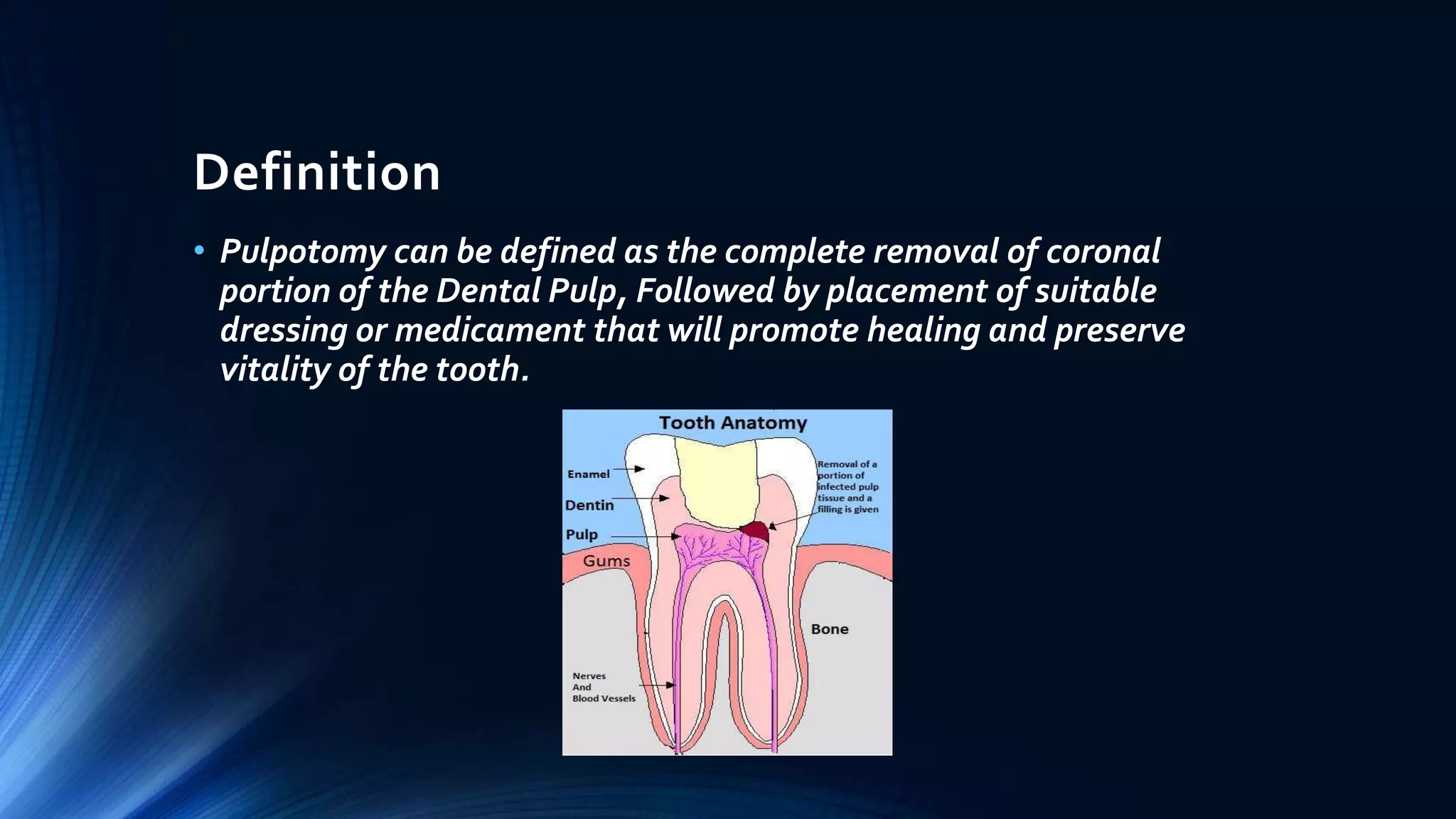 Pulpotomy | PPTX