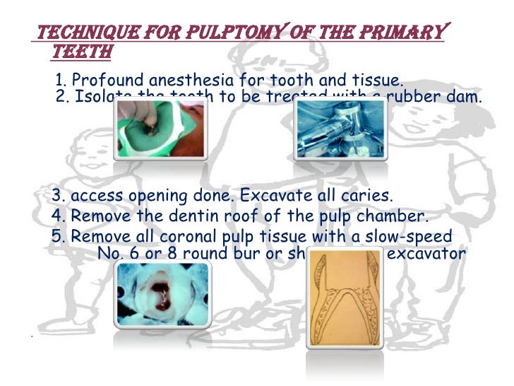 Pulpotomy.pptmine