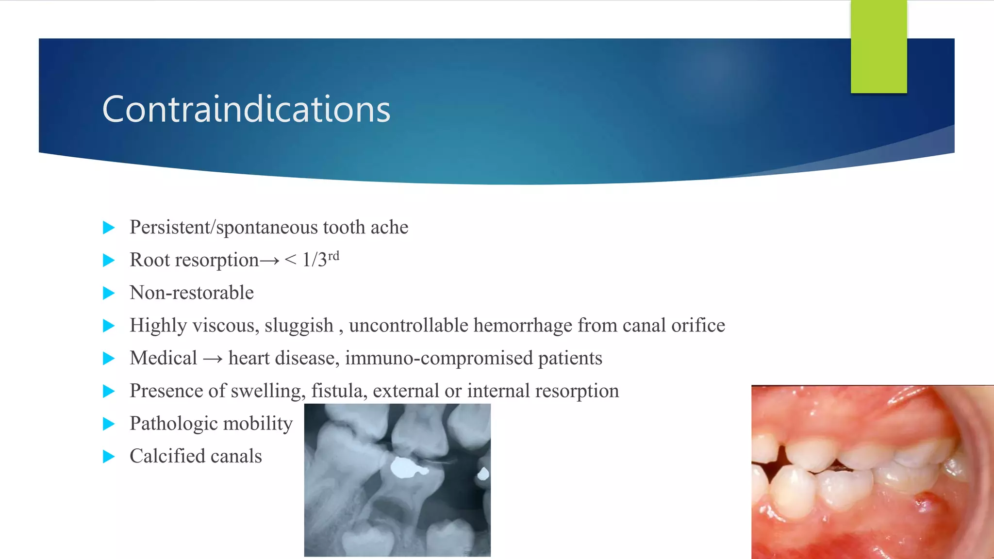 PULPOTOMY Dr. Amrutha Joy.pptx