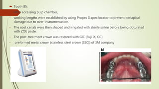 Pulpotomy management using laser diode in pediatric patient-JOURNAL ...