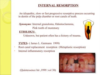 Pulp and periapical pathology presntation part 2 | PPT