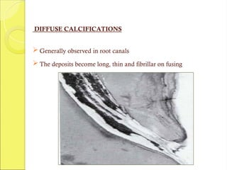 Pulp and periapical pathology presntation part 2 | PPT